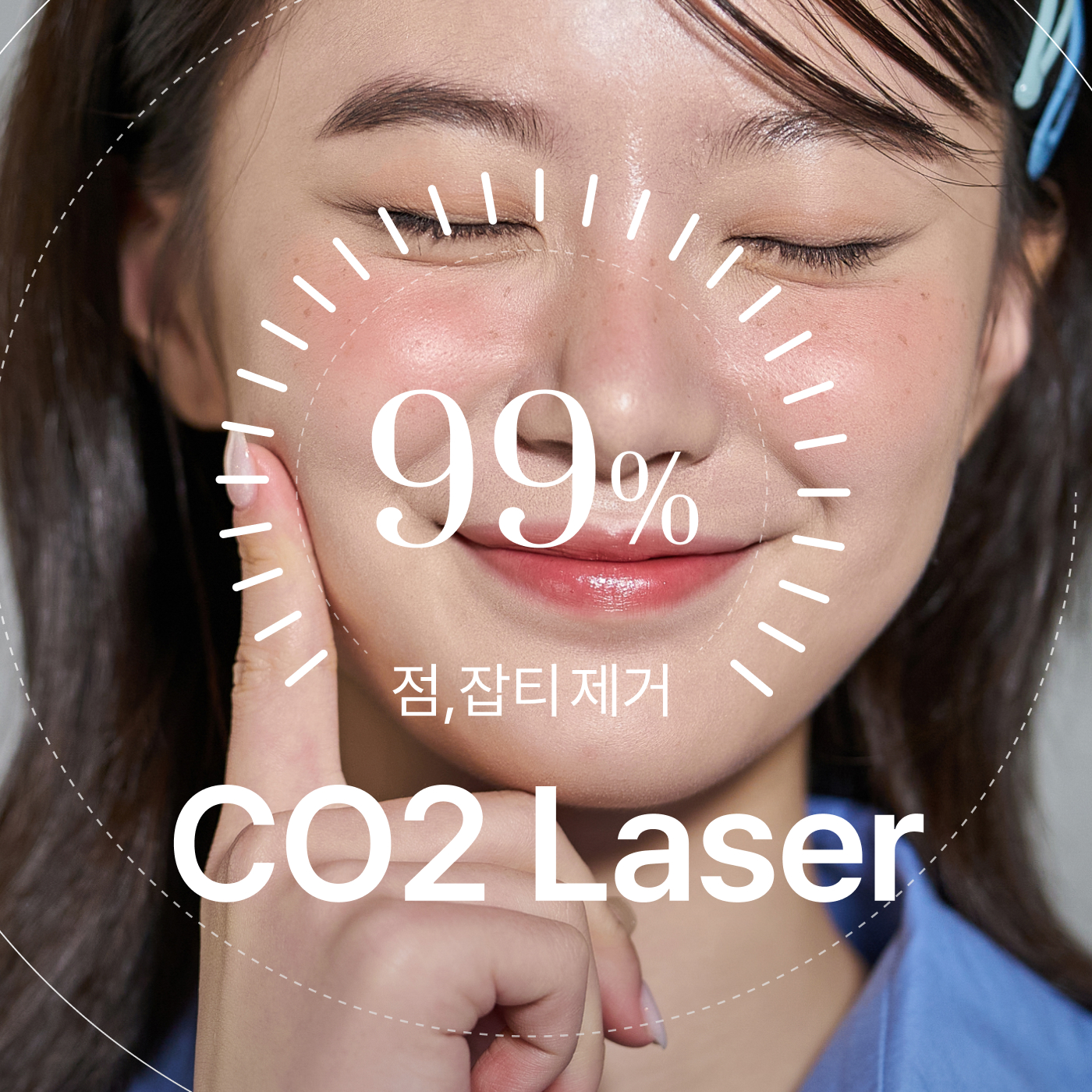 모두 다 제거-CO2 Laser 할인, 가격, 후기, 전후, 효과 정보 by 연세고운미의원 | 여신티켓 - 국내 1등 피부과, 성형외과 플랫폼