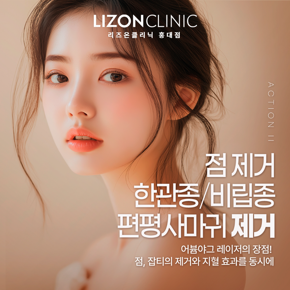 점 비립종 편평사마귀 제거 무제한 할인 가격 후기 전후 효과 정보 By 리즈온의원홍대점 여신티켓 국내 1등 피부과 성형외과 플랫폼