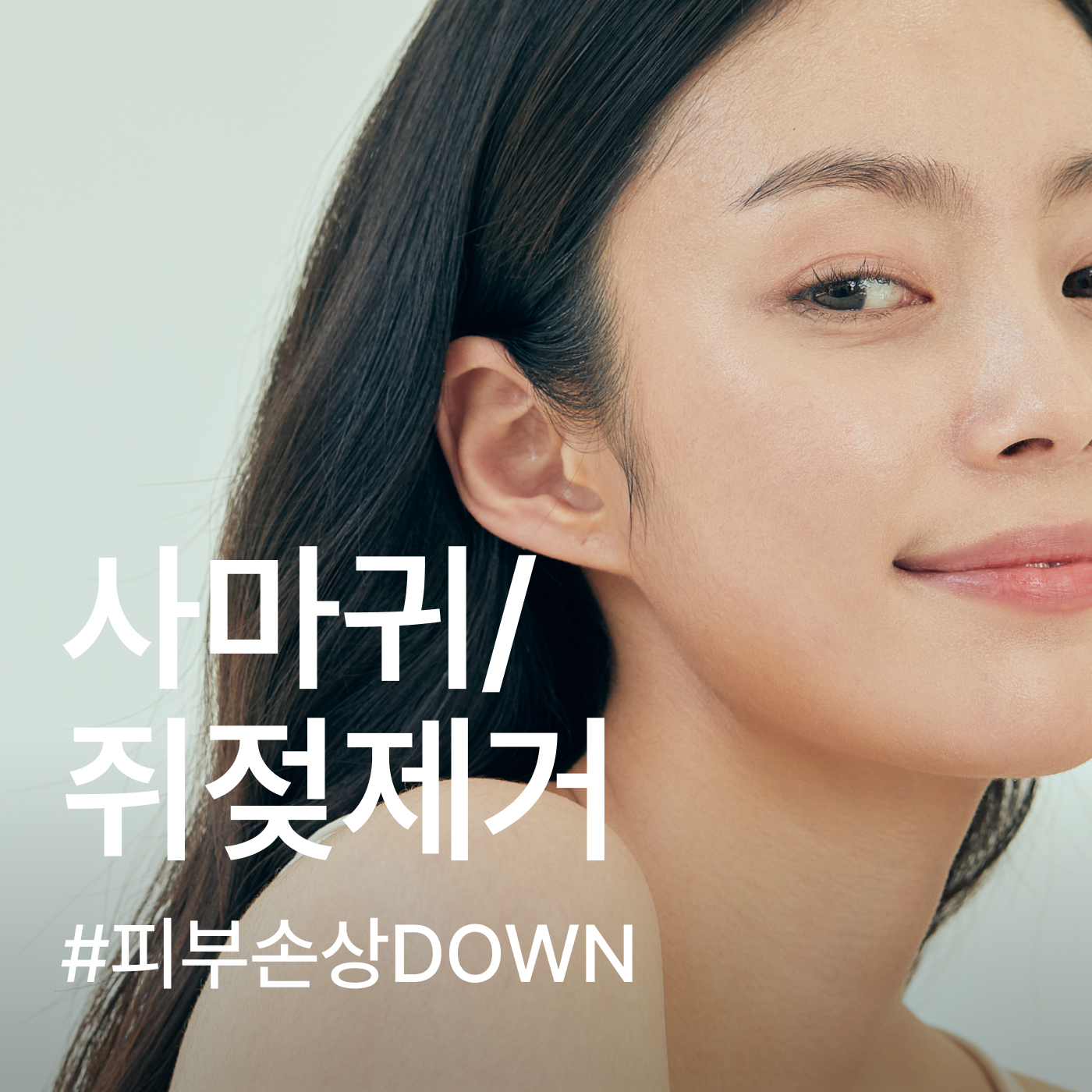 사마귀 쥐젖 제거전문의 할인 가격 후기 전후 효과 정보 By 청담봄온의원 여신티켓 국내 1등 피부과 성형외과 플랫폼