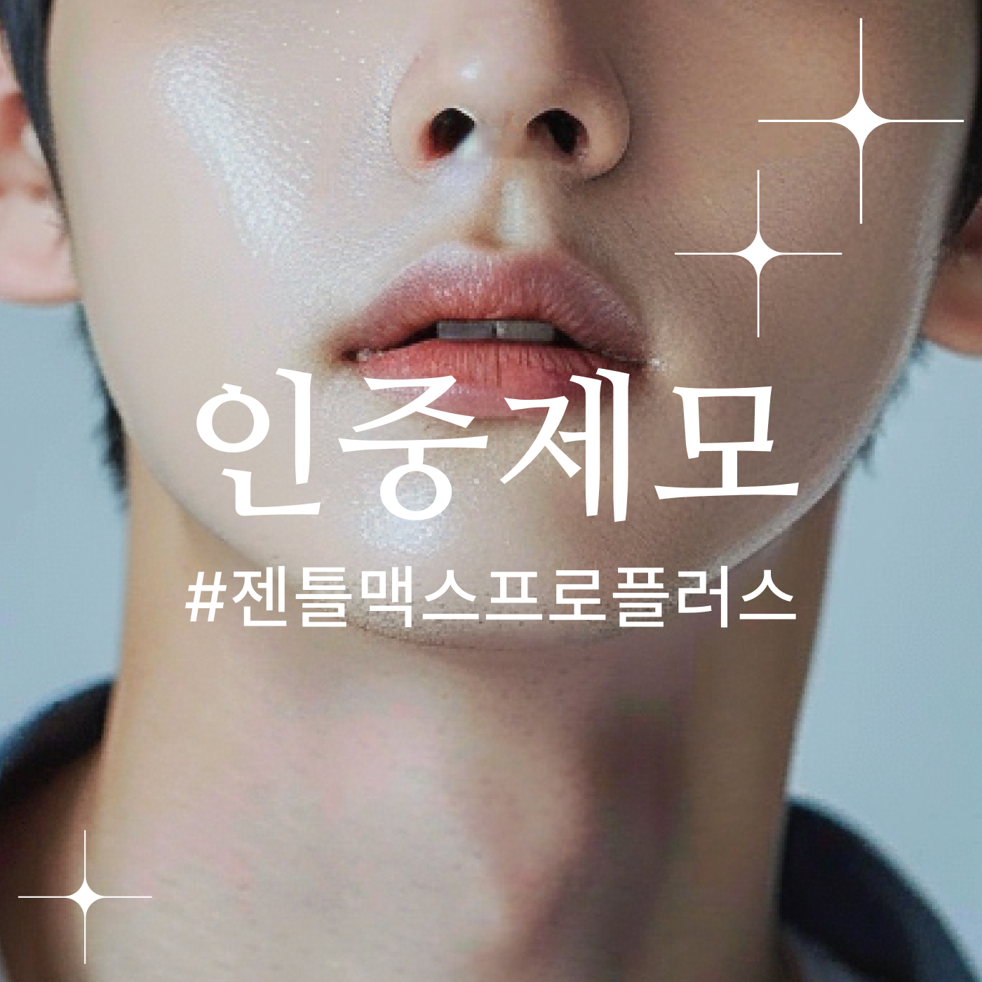 젠틀맥스프로플러스 인중제모 할인 가격 후기 전후 효과 정보 By 셀린의원분당정자점 여신티켓 국내 1등 피부과 성형외과 플랫폼