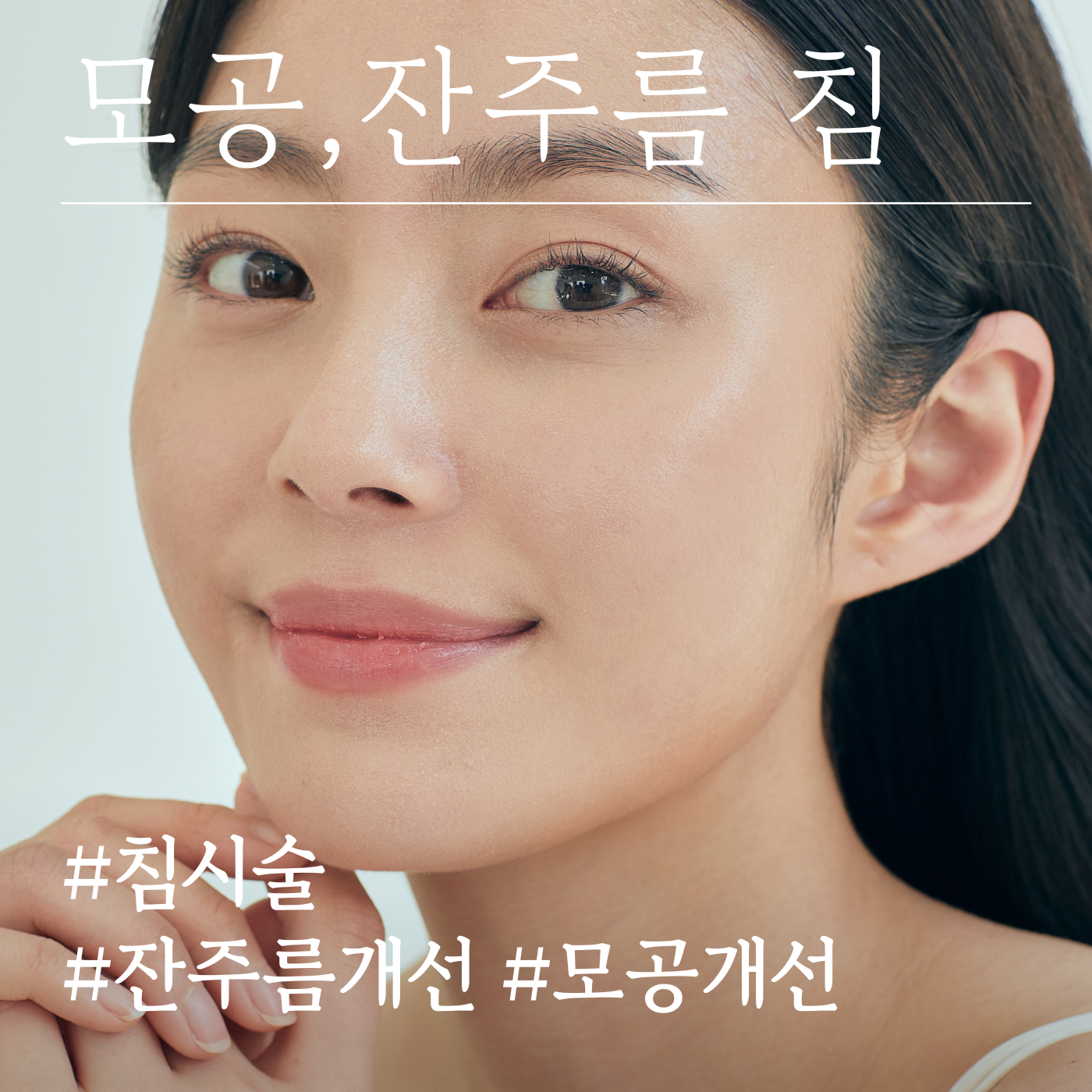 모공∙잔주름∙탄력 매선리프팅 연예인침 할인 가격 후기 전후 효과 정보 By 참다인한의원 여신티켓 국내 1등 피부과 성형외과 플랫폼