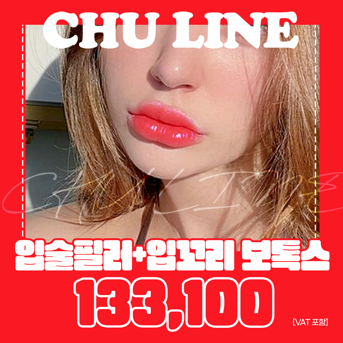 Chu Line입술필러 입꼬리 할인 가격 후기 전후 효과 정보 By 글로비지테라안티에이징의원 여신티켓 국내 1등 피부과 성형외과 플랫폼