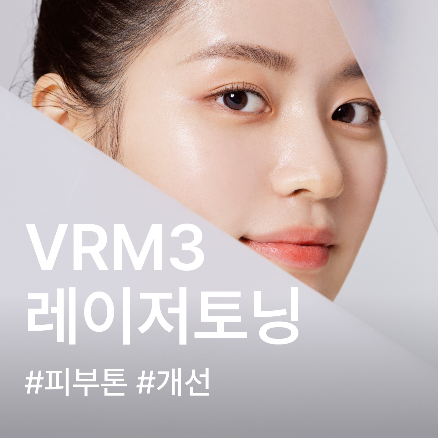 VRM III 레이저 토닝 1회 할인, 가격, 후기, 전후, 효과 정보 by 리센트의원 | 여신티켓 - 국내 1등 피부과, 성형외과 플랫폼