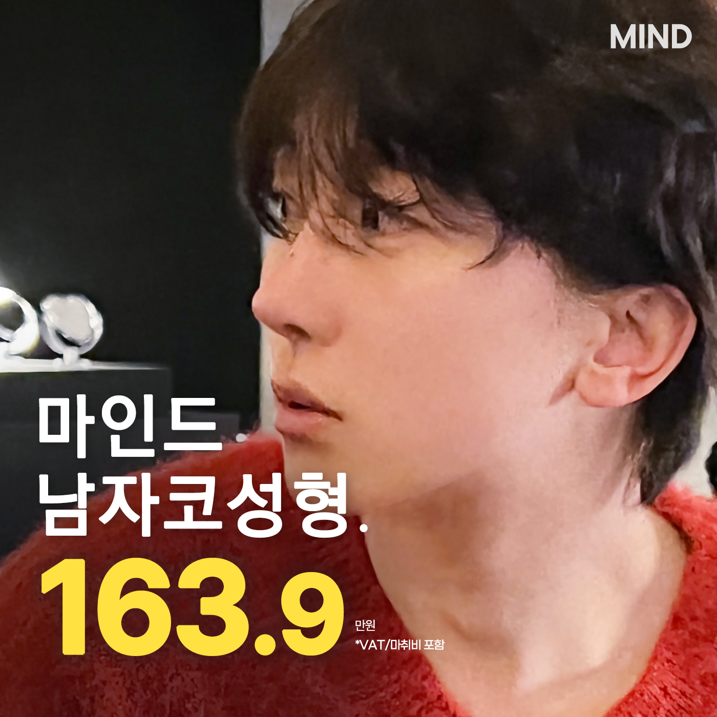 마인드 남자코성형 할인 가격 후기 전후 효과 정보 By 마인드성형외과의원 여신티켓 국내 1등 피부과 성형외과 플랫폼