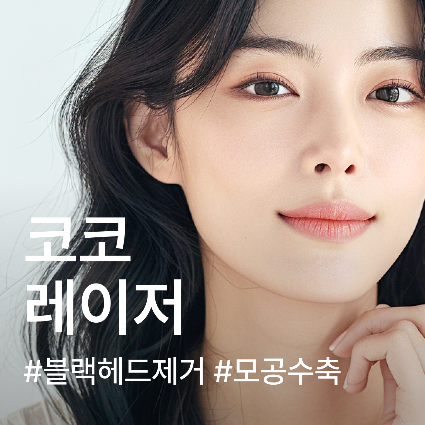블랙헤드 제거엔 코코레이저 나비존코 할인 가격 후기 전후 효과 정보 By 닥터디자이너의원영등포점 여신티켓