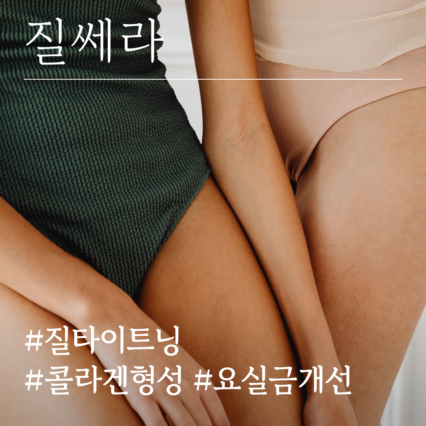 질쎄라 할인 가격 후기 전후 효과 정보 By 애플산부인과의원신촌점 여신티켓 국내 1등 피부과 성형외과 플랫폼