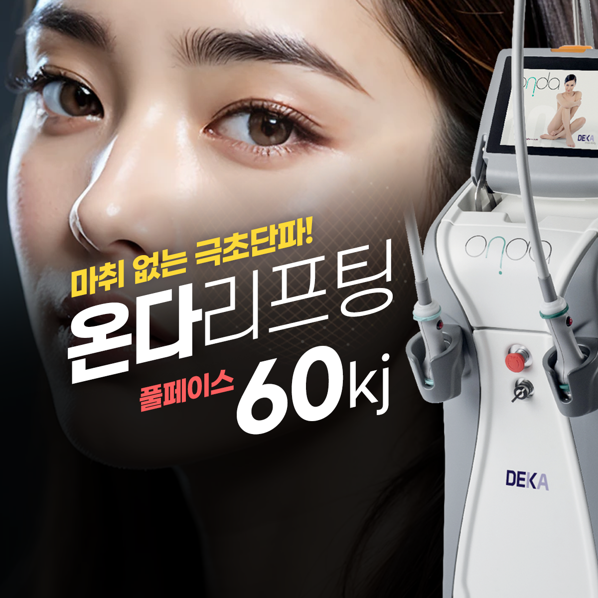 극초단파 온다 리프팅 60kj 할인 가격 후기 전후 효과 정보 By 튠의원압구정점 여신티켓 국내 1등 피부과 성형외과 플랫폼