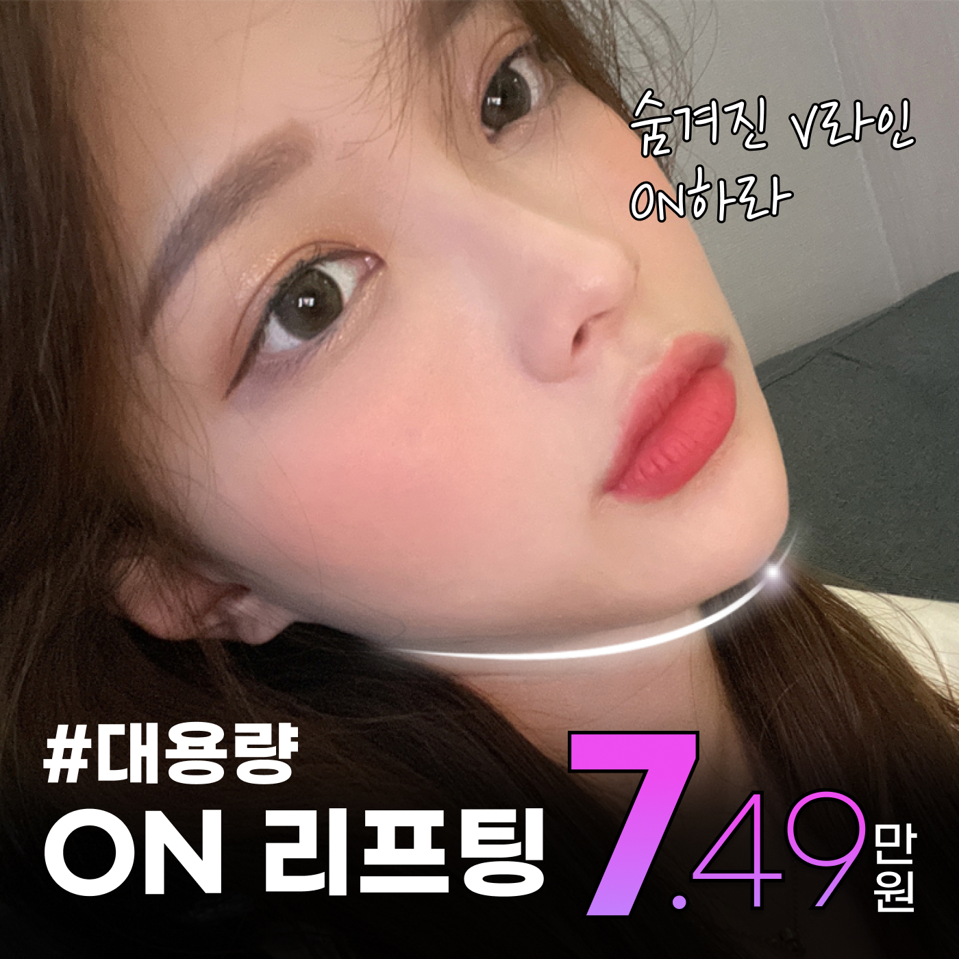 대용량 온리프 윤곽주사 온리프팅주사 할인 가격 후기 전후 효과 정보 By 온리프성형외과 여신티켓 국내 1등 피부과 성형외과 플랫폼