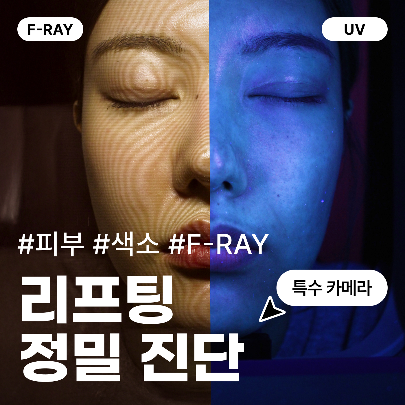 리드림의원 피부과 피부진단 F Ray 할인 가격 후기 전후 효과 정보 By 리드림의원의료법인미래의료재단 여신티켓 국내 1등 피부과 성형외과 플랫폼