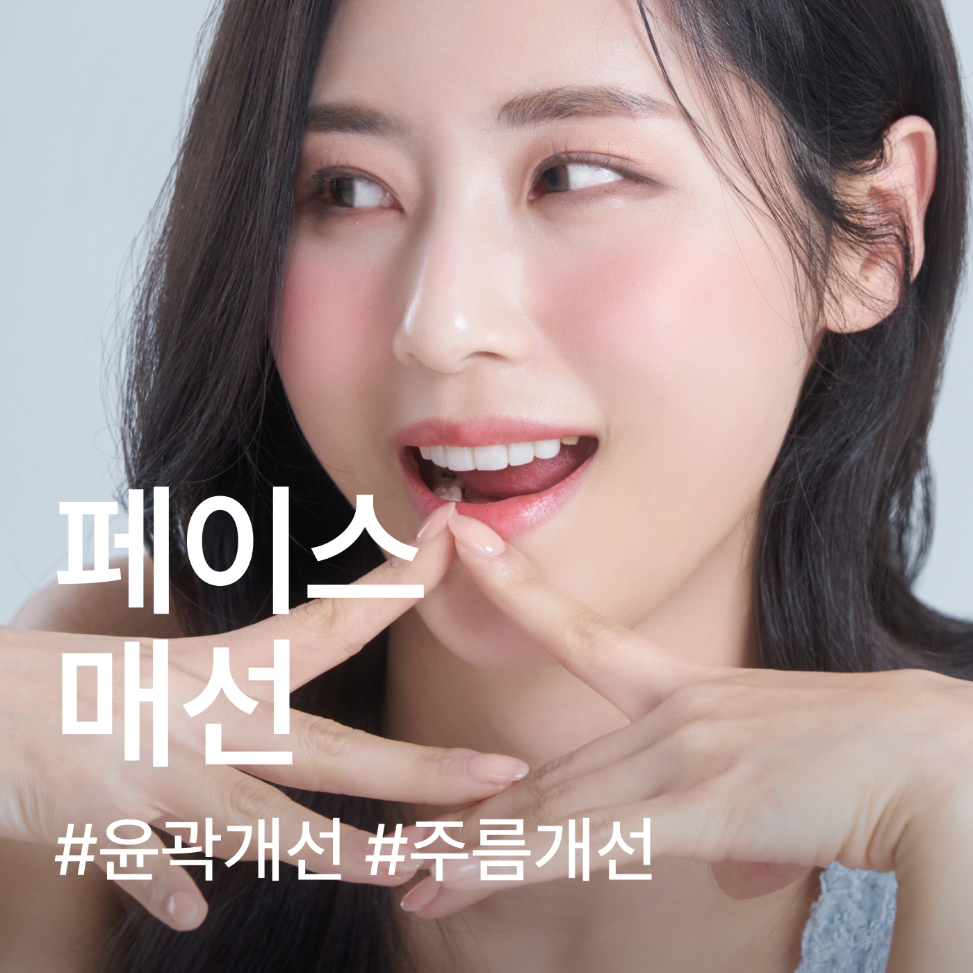 V라인 리프팅매선and탄력매선 할인 가격 후기 전후 효과 정보 By 가로세로한의원강남점 여신티켓 국내 1등 피부과 성형외과 플랫폼