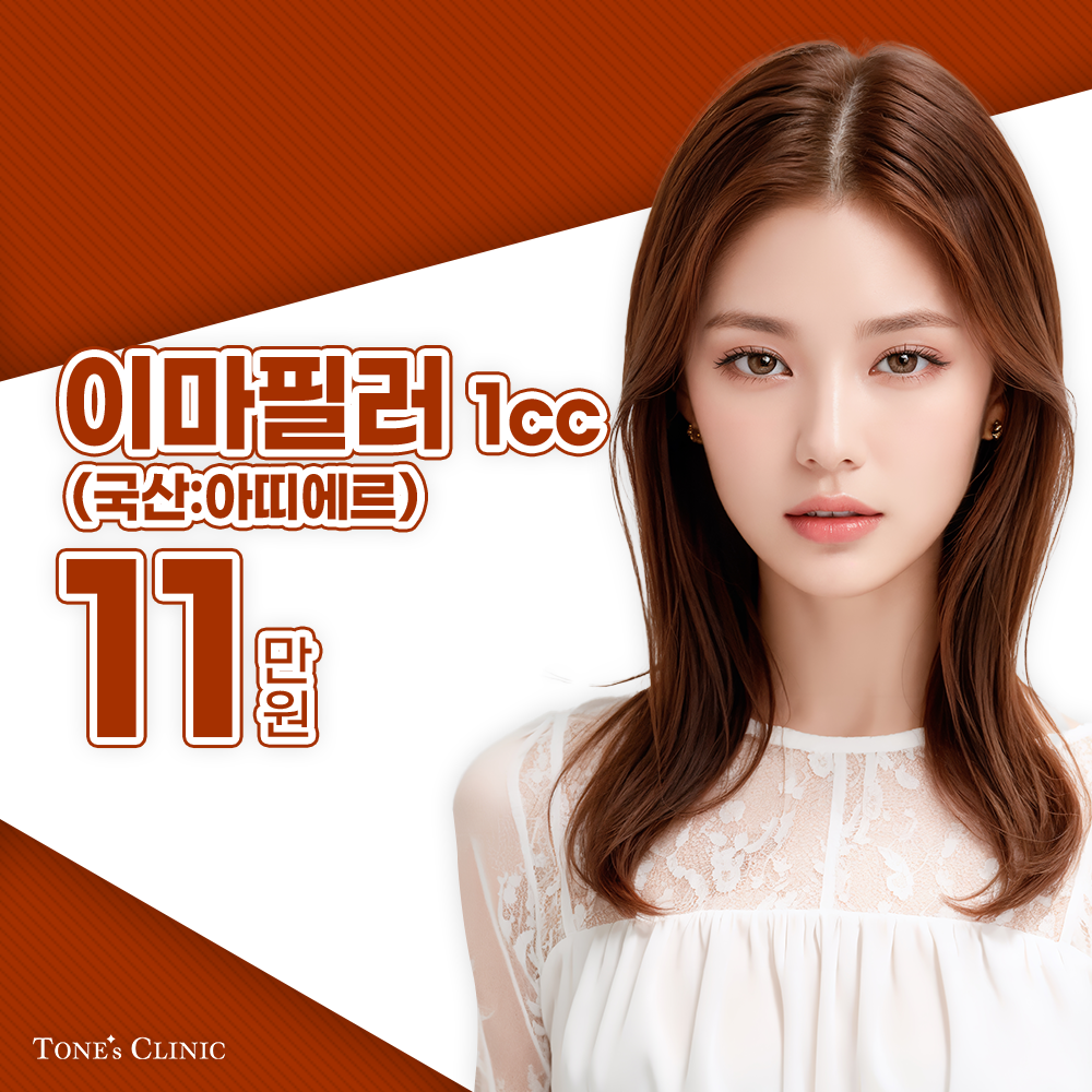 자연스러운 이마 볼륨 이마필러 할인 가격 후기 전후 효과 정보 By 톤즈의원홍대점 여신티켓 국내 1등 피부과