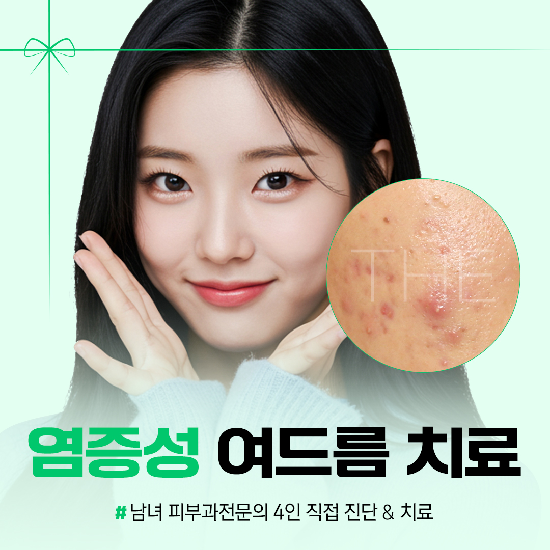 피부과 전문의 염증성 여드름 치료 할인 가격 후기 전후 효과 정보 By 더피부과의원 여신티켓 국내 1등 피부과 성형외과 플랫폼