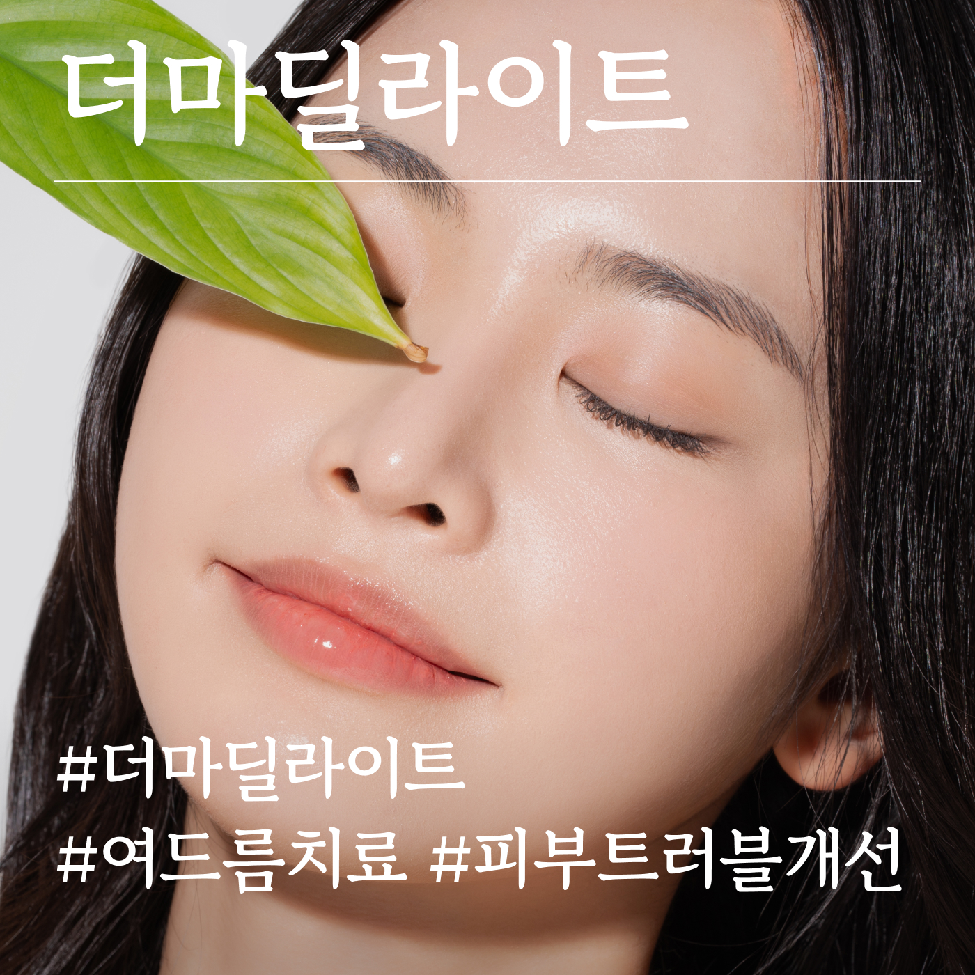 더마딜라이트 활성산소 여드름케어 패키지 할인 가격 후기 전후 효과 정보 By 오블리브의원 여신티켓 국내 1등 피부과 성형외과 플랫폼