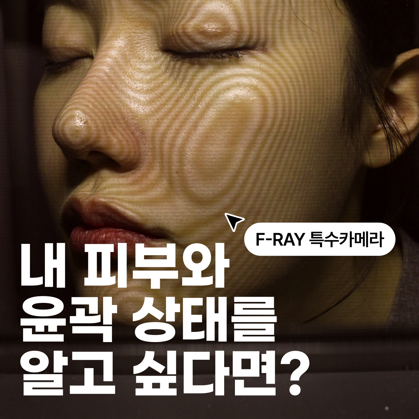 F Ray 11 컨설팅 피부 진단 할인 가격 후기 전후 효과 정보 By 아이에이치의원 여신티켓 국내 1등 피부과