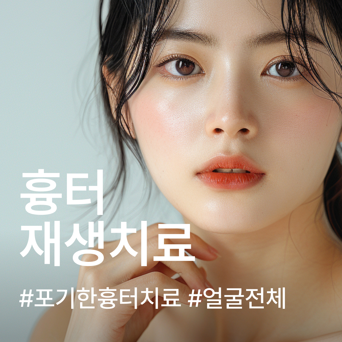 흉터 재생 치료 흉터 치료 얼굴 전체 할인 가격 후기 전후 효과 정보 By 닥터퀸스의원강남본점 여신티켓