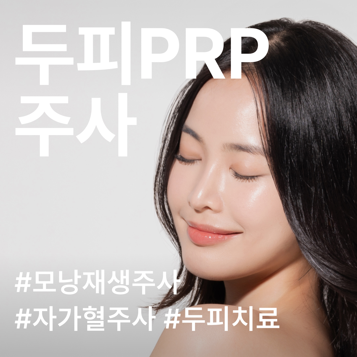 PRP 자가혈주사 할인, 가격, 후기, 전후, 효과 정보 by 자라다의원 | 여신티켓 - 국내 1등 피부과, 성형외과 플랫폼