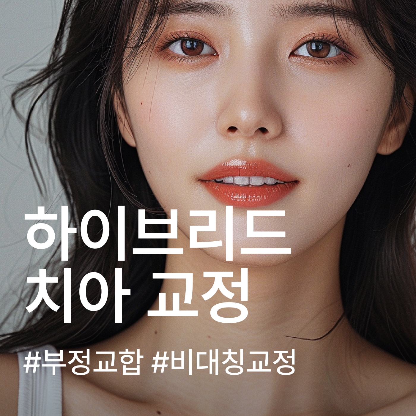 하이브리드 치아 교정 할인, 가격, 후기, 전후, 효과 정보 by 연세하랑치과의원 | 여신티켓 - 국내 1등 피부과, 성형외과 플랫폼